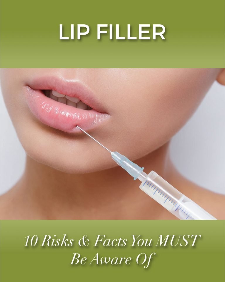 10 Lip Filler Risks and Facts You MUST Be Aware Of! - Youthtopia Med Spa